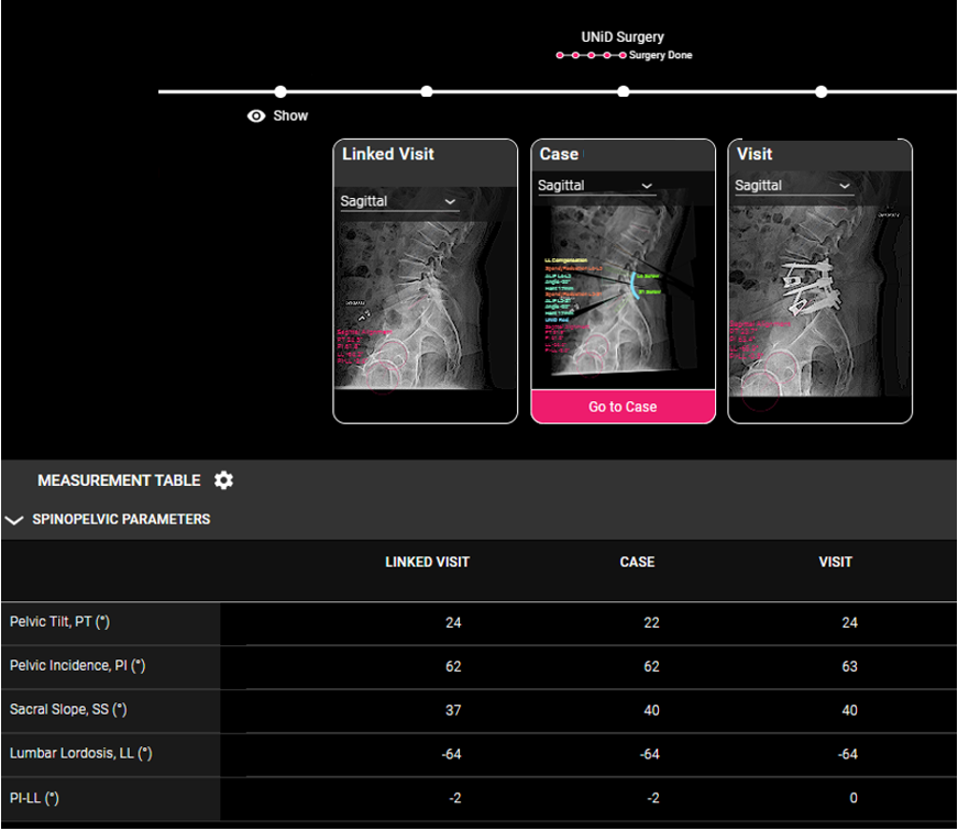 Medtronic Cranial & Spinal Technologies | Featured Cases | Daniels